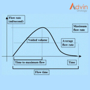 Uroflowmetry - Advin Urology