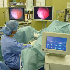 Optical Urethrotomy - Advin Urology